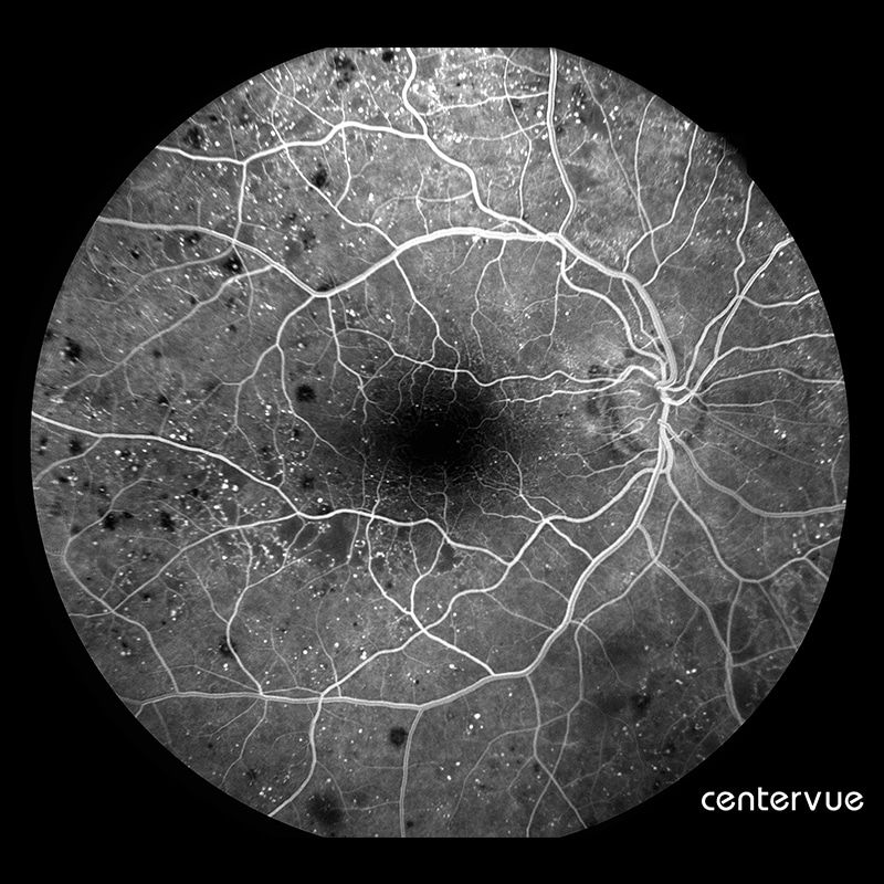 iCare EIDON Confocal Scanner - Mainline Instruments