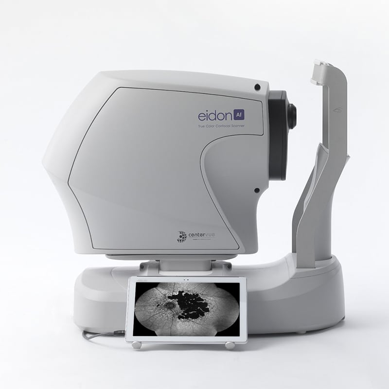 iCare EIDON AF Confocal Scanner - Mainline Instruments