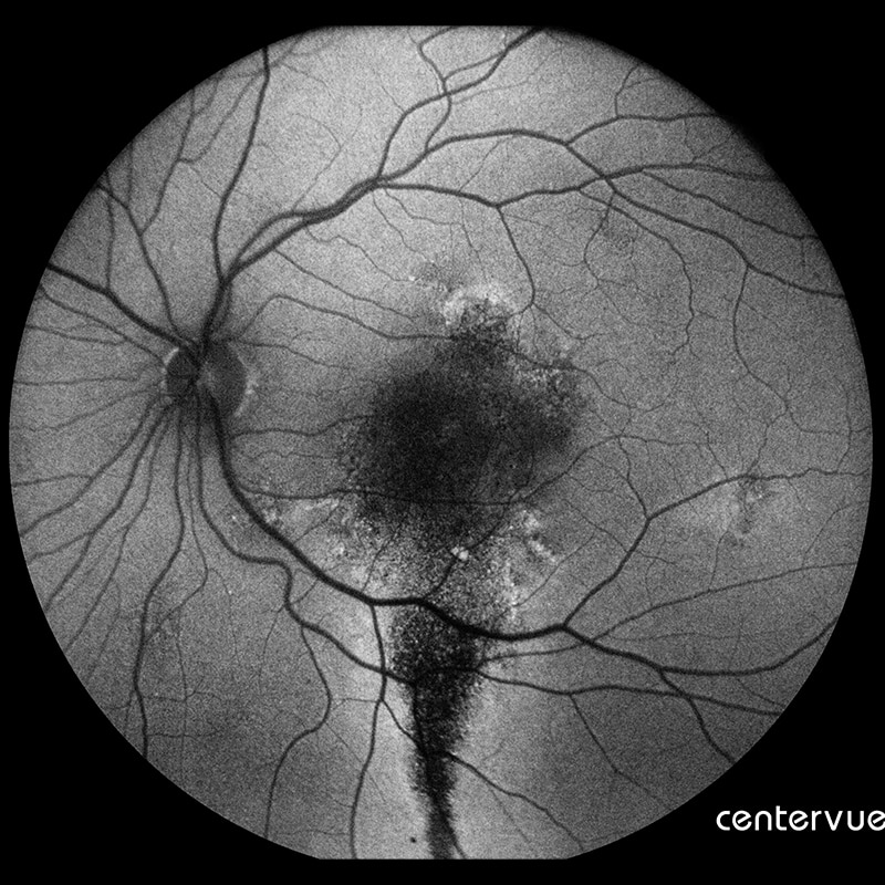 iCare EIDON AF Confocal Scanner - Mainline Instruments