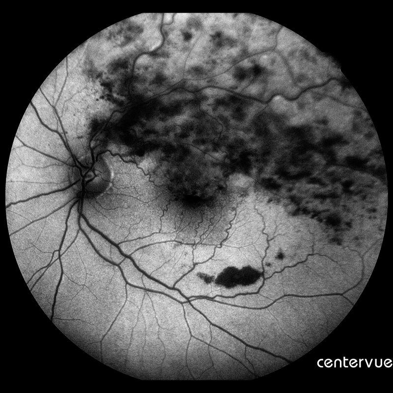 iCare EIDON AF Confocal Scanner - Mainline Instruments