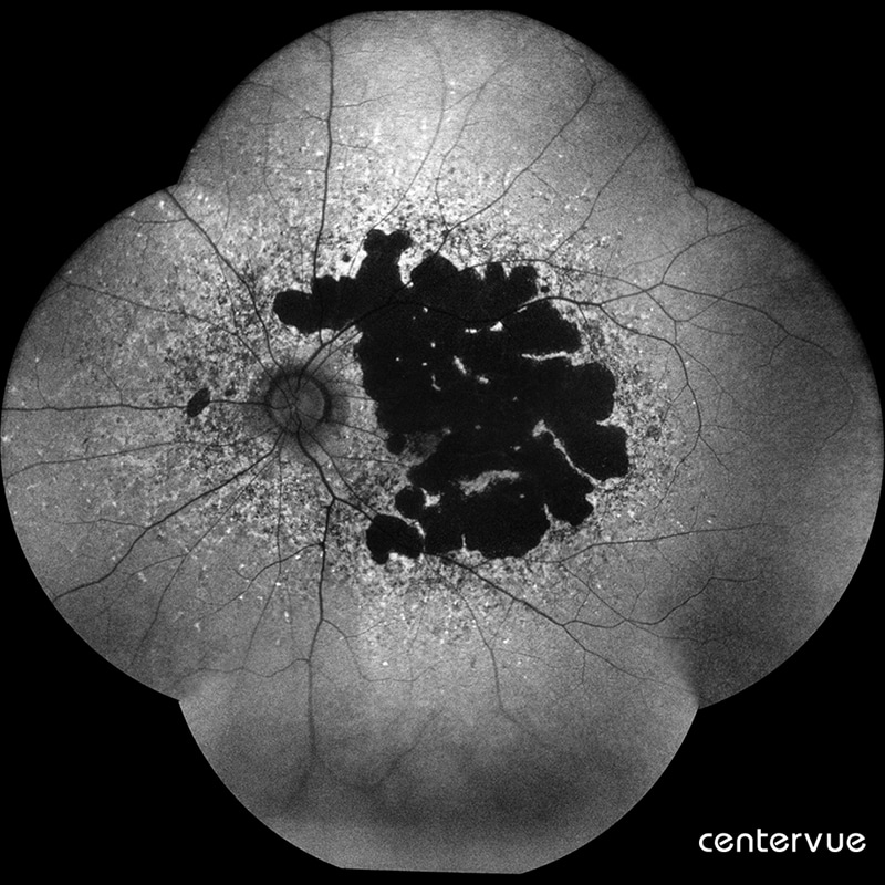 iCare EIDON AF Confocal Scanner - Mainline Instruments